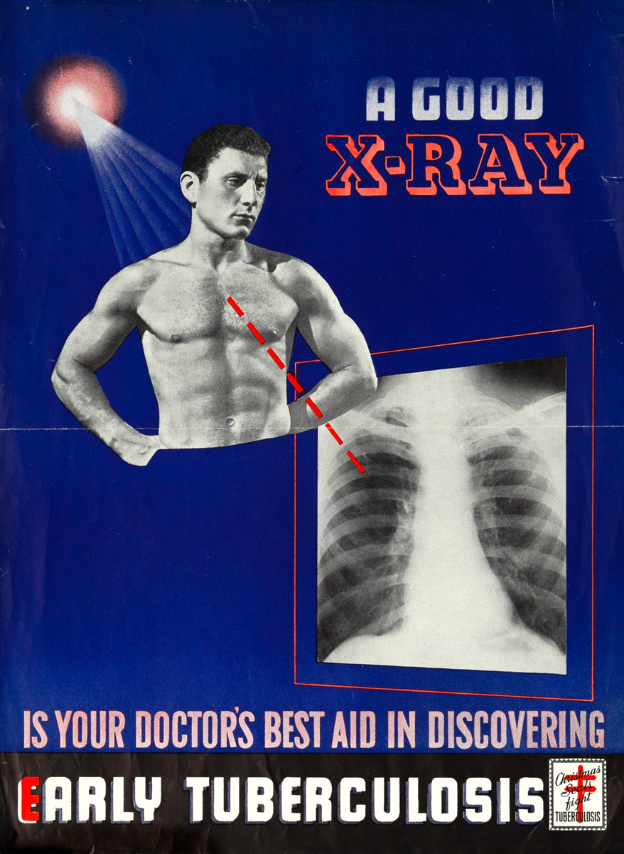 A Good X-Ray Original Tuberculosis Health Poster | David Pollack ...